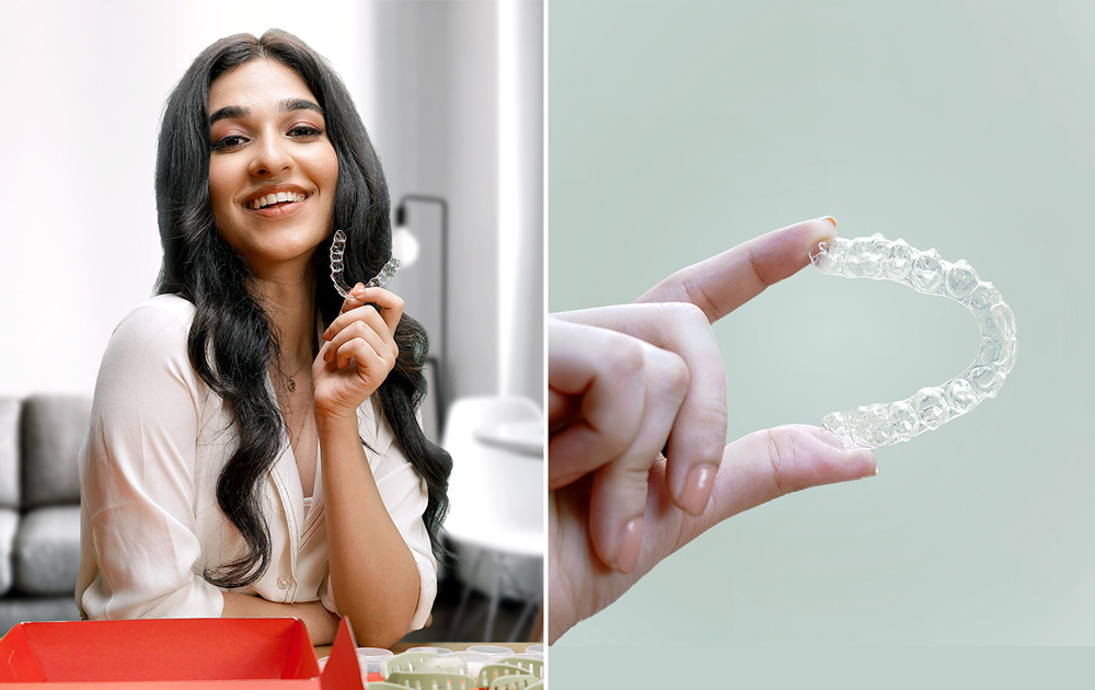 Gift yourself a dazzling smile makeover before your big day with ...